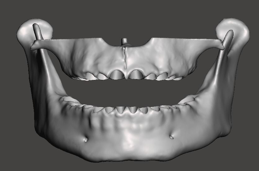 Human maxillary and mandibular jaws with typodont 3D model 3D printable ...