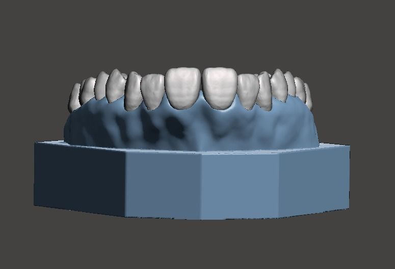 D001 Dental Sample model 3D model 3D printable | CGTrader
