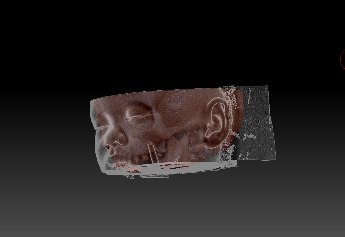 SKULL-Skin MRI 3D model 3D printable | CGTrader