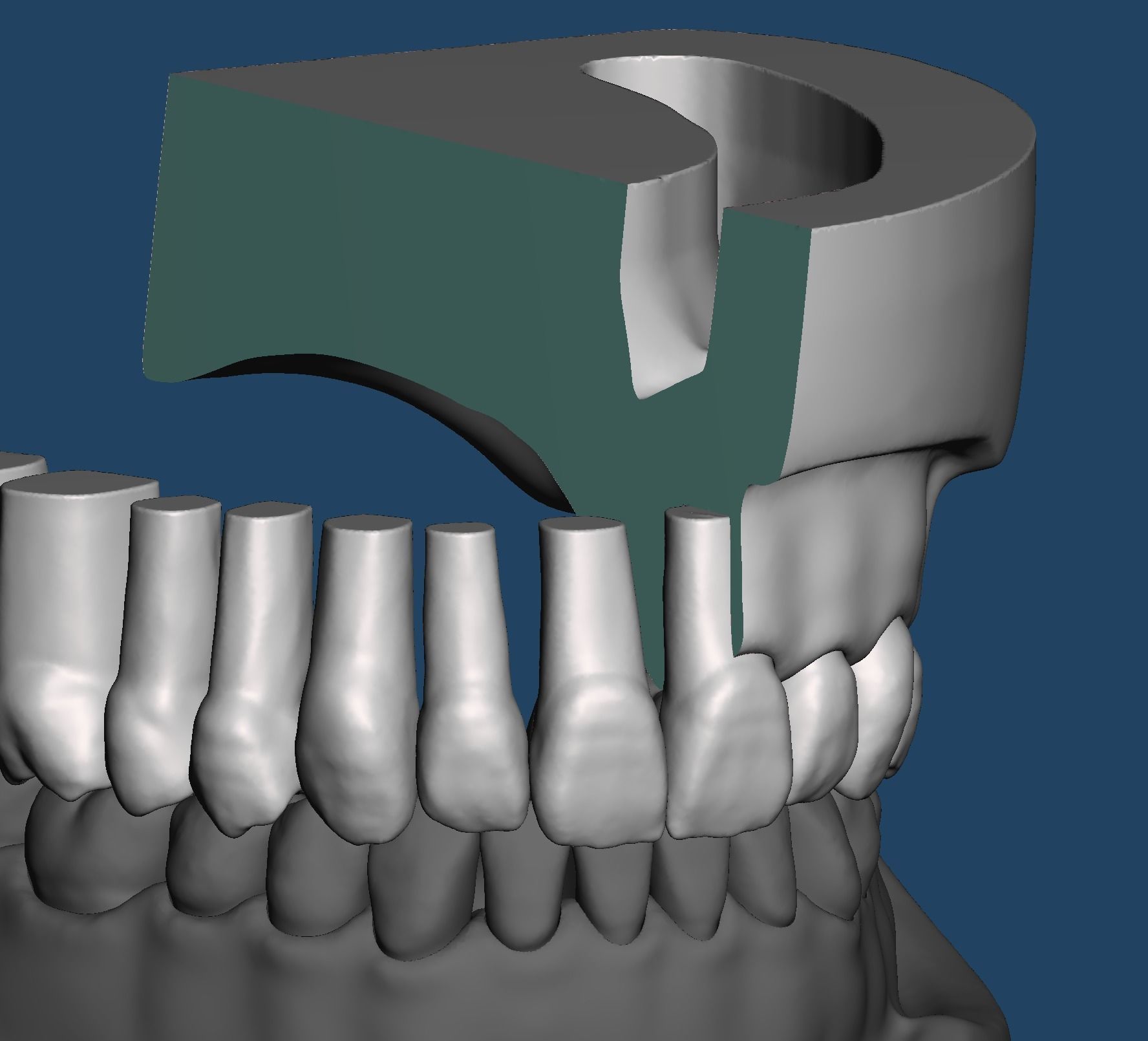 Dental Sample model 3D model 3D printable | CGTrader