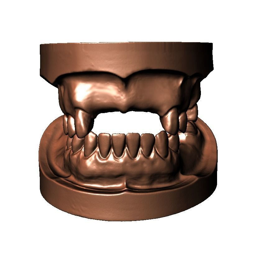 3D model Dental Model rpd cast upper lower VR / AR / low-poly | CGTrader