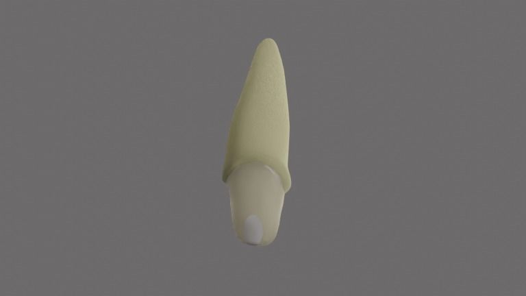 Fiber post and core with single crown - Anterior tooth 3D model | CGTrader
