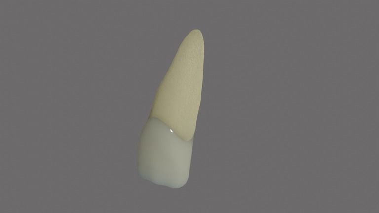Fiber post and core with single crown - Anterior tooth 3D model | CGTrader