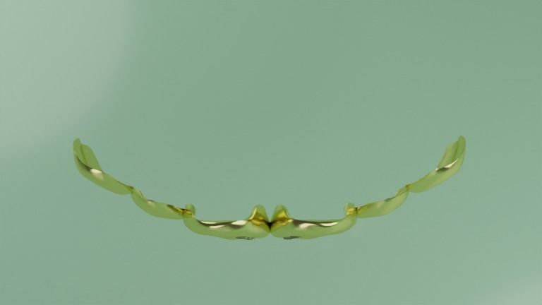 Grillz with diamonds in the front teeth 3D model | CGTrader
