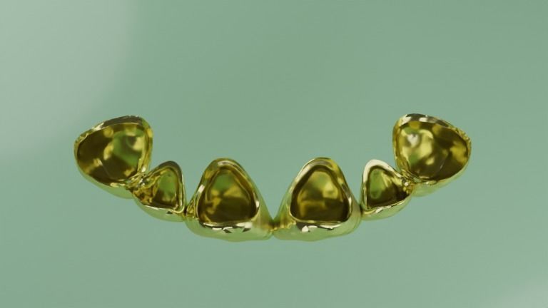 Grillz with textured teeth - gold 3D model | CGTrader