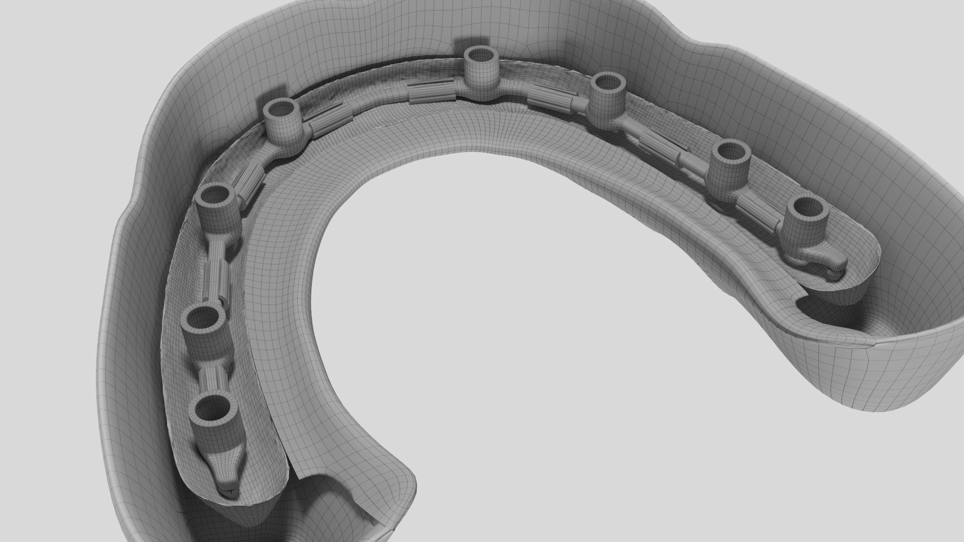 Hibrid implant bar attachment 3D model | CGTrader