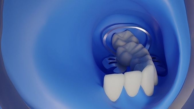 Rubber dam - Endodontics and restorative dentistry 3D model | CGTrader