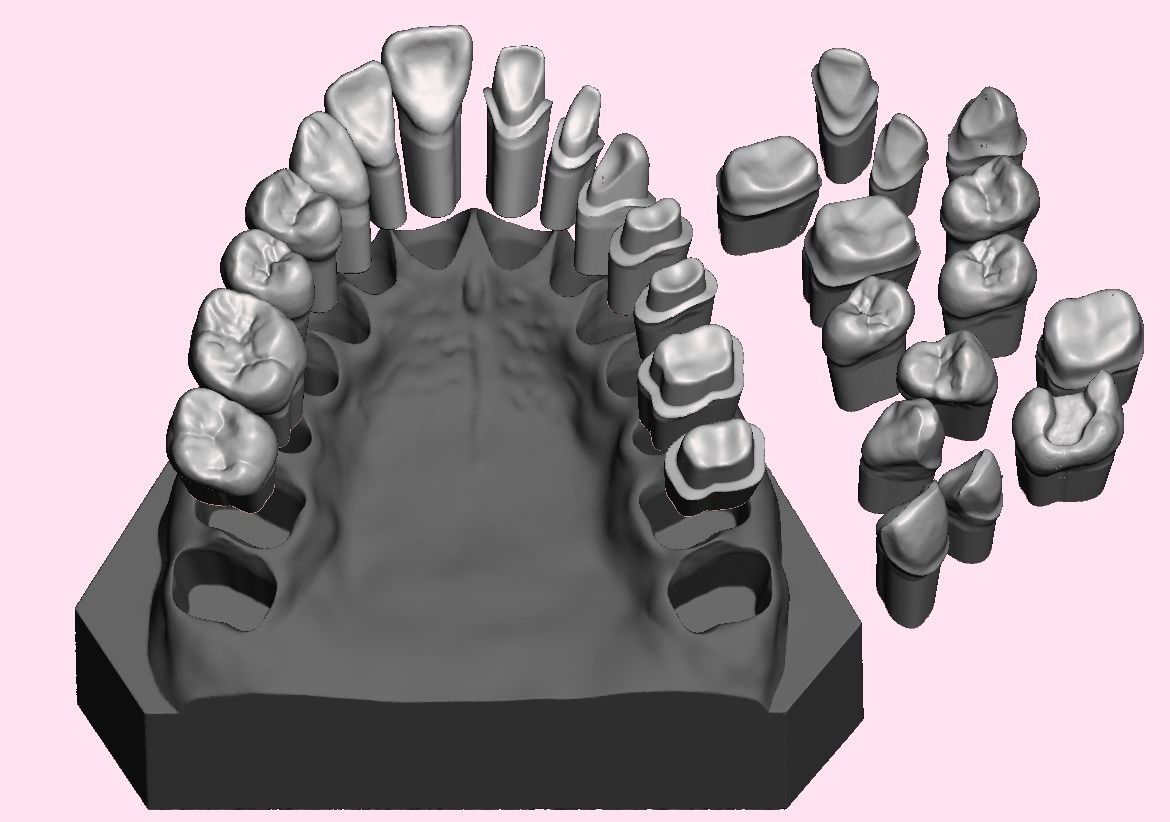 Full die set dental sample model maxillar | CGTrader