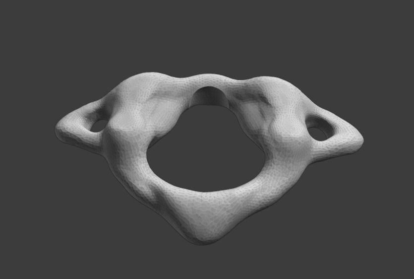 Atlas C1 vertebra 3D model 3D printable | CGTrader