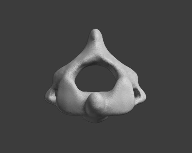 Axis C2 vertebra 3D model 3D printable | CGTrader