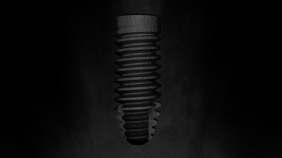 Dental implant Cylindrical geometry and morse taper connection 3D model ...