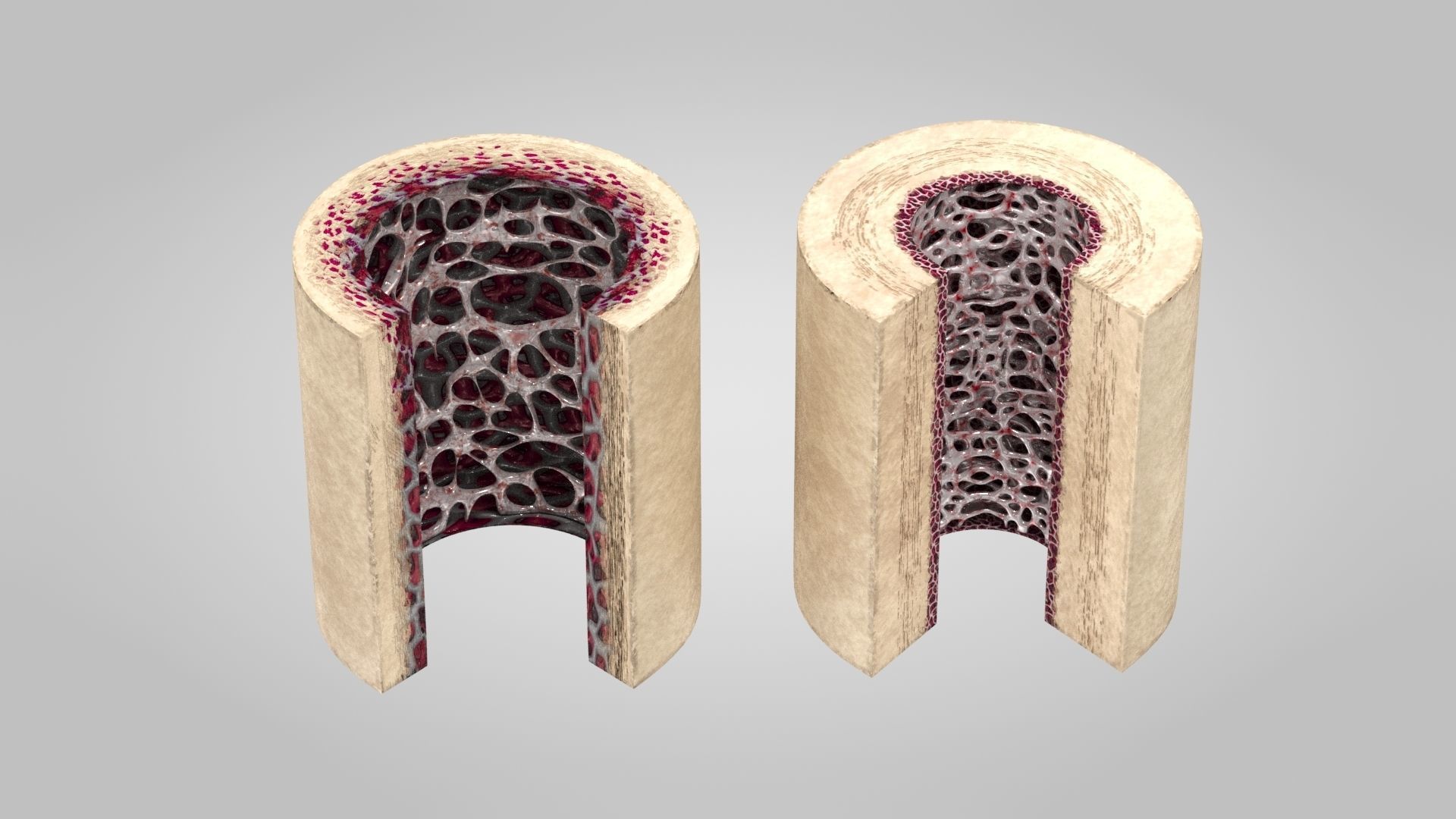 Healthy and Osteoporotic Bone Section 3D model | CGTrader