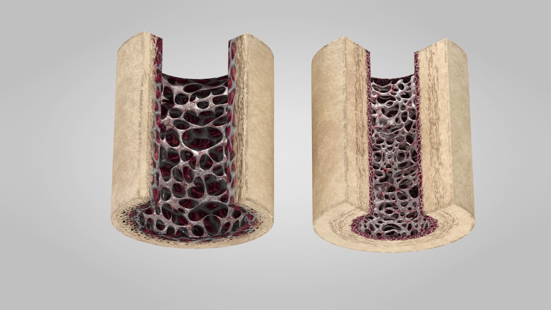 Healthy and Osteoporotic Bone Section 3D model | CGTrader