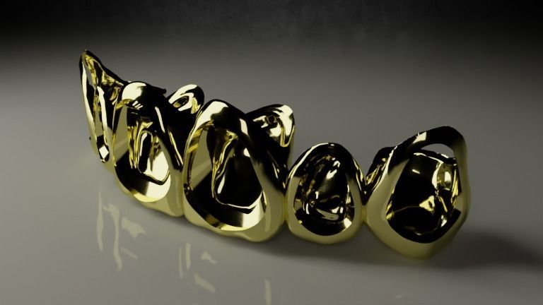 Grillz - gold teeth 3D model | CGTrader
