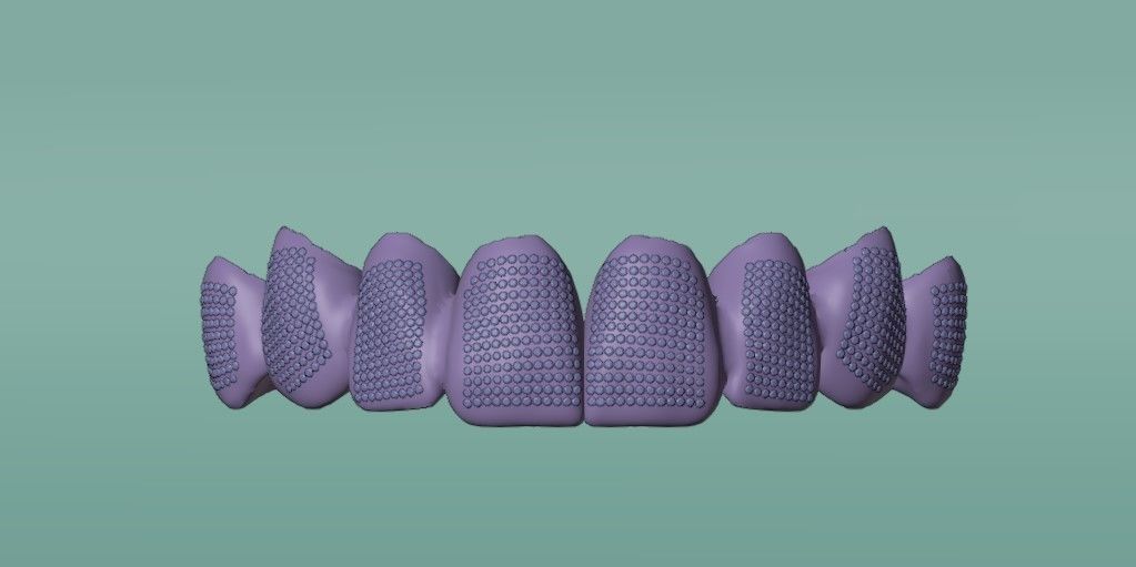 Grillz with diamonds 3D model | CGTrader