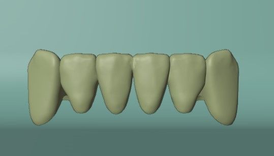 Lower Grillz - gold teeth 3D model | CGTrader