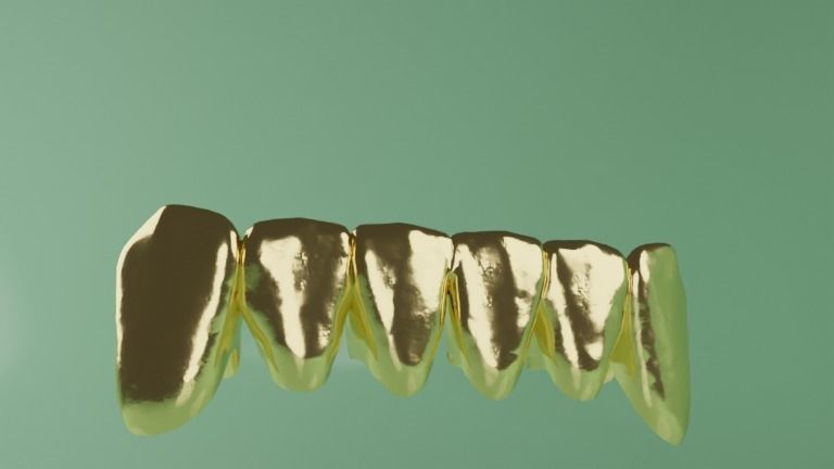 Lower Grillz - gold teeth 3D model | CGTrader