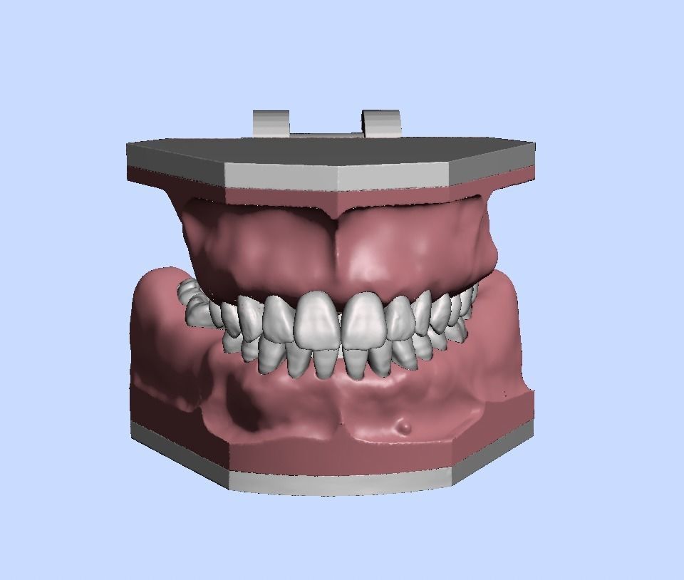 D011 Oral surgery and perio model 3D model 3D printable | CGTrader
