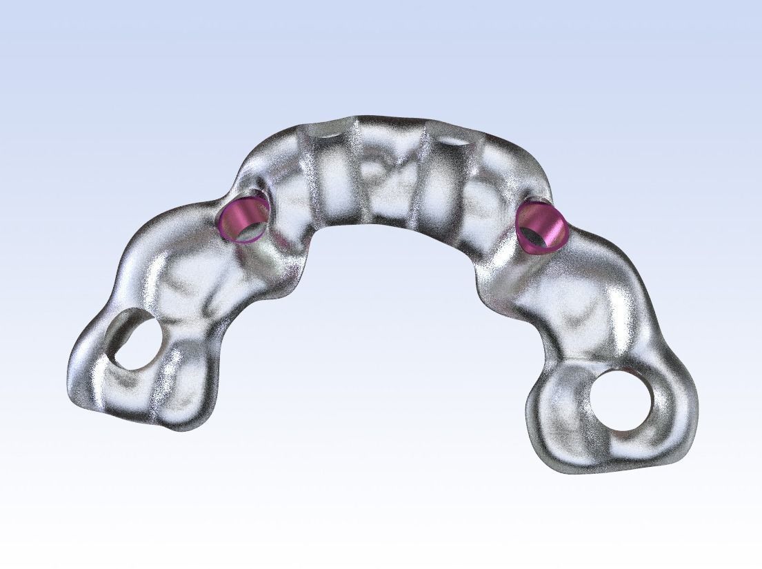 Digital Drilling Guide with Sleeves 3D model 3D printable | CGTrader