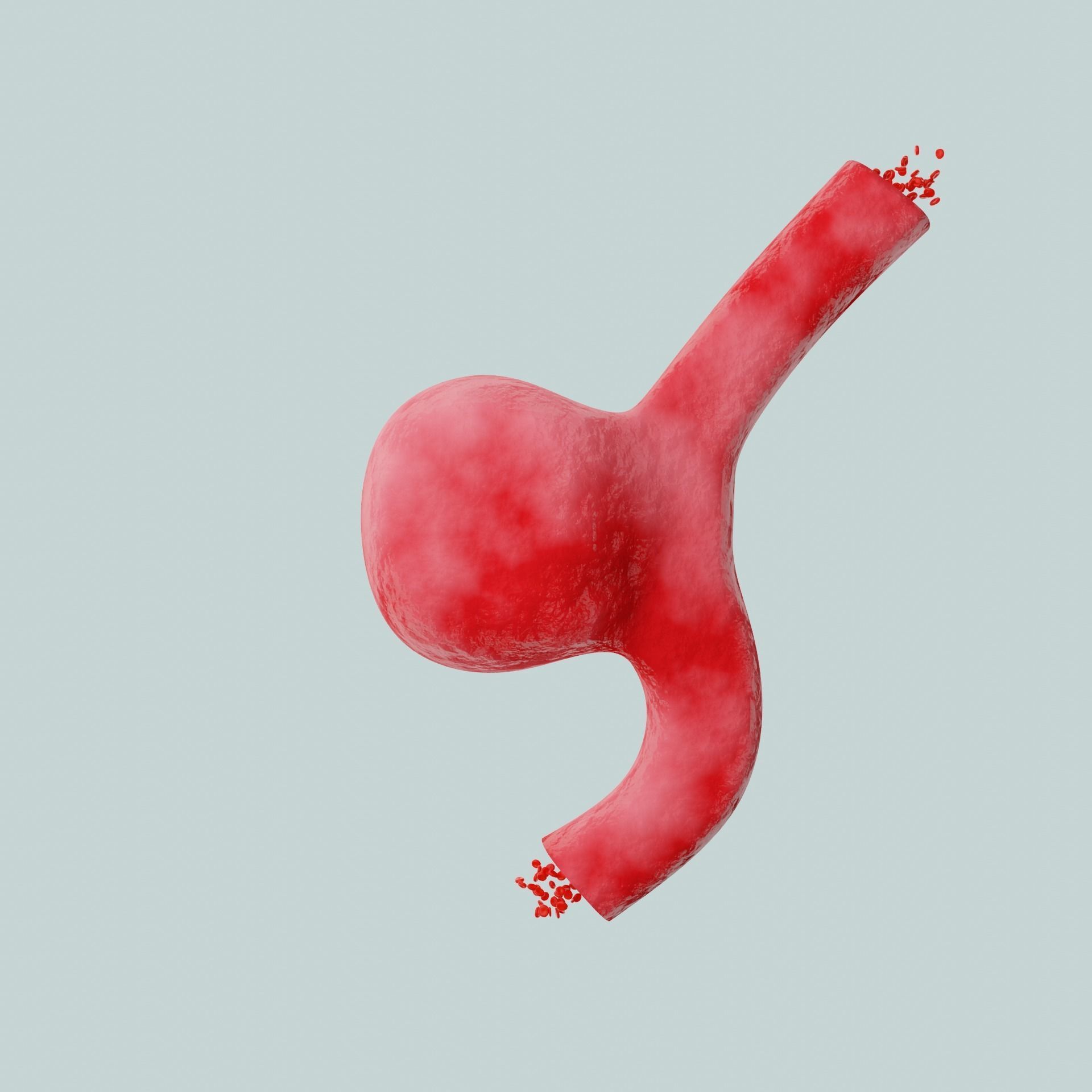 3D model Aneurysm ruptured photorealistic animated VR / AR / low-poly ...