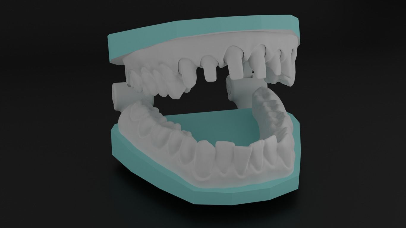 Human teeth restoration 3D model 3D printable | CGTrader