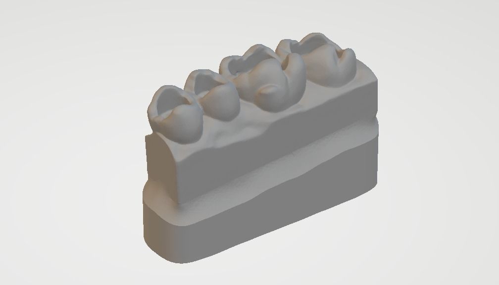 Guidline in composite filling 3D model 3D printable | CGTrader