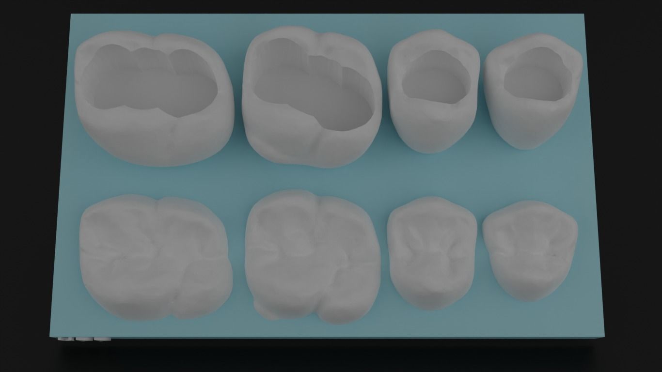 Dental Upper Arch Models 3D print model 3D model 3D printable | CGTrader