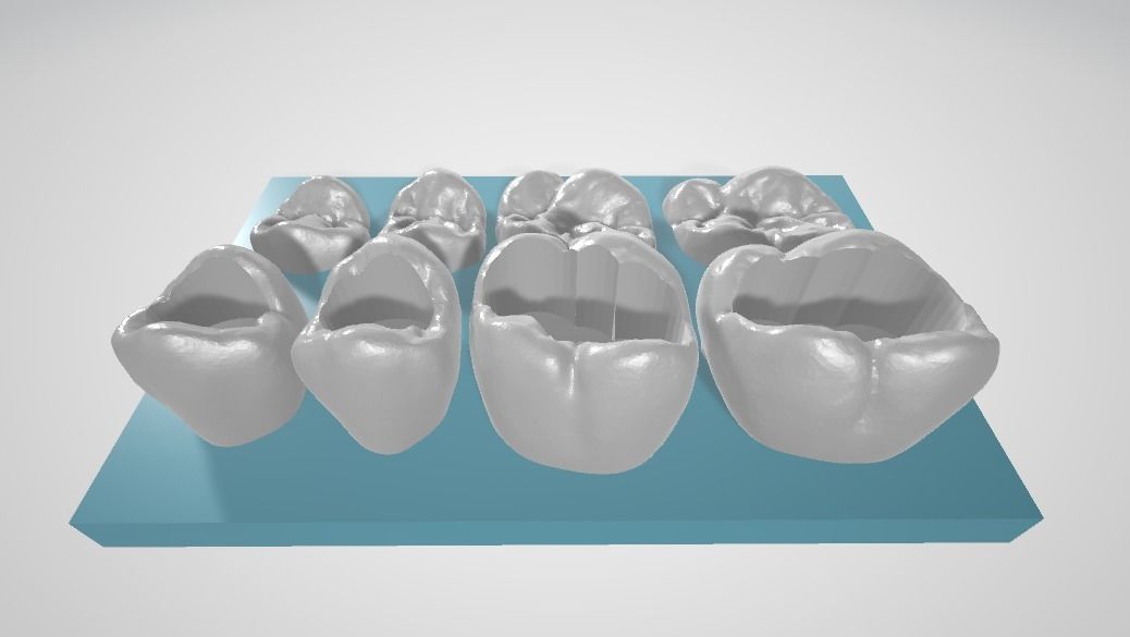 Dental Upper Arch Models 3D print model 3D model 3D printable | CGTrader
