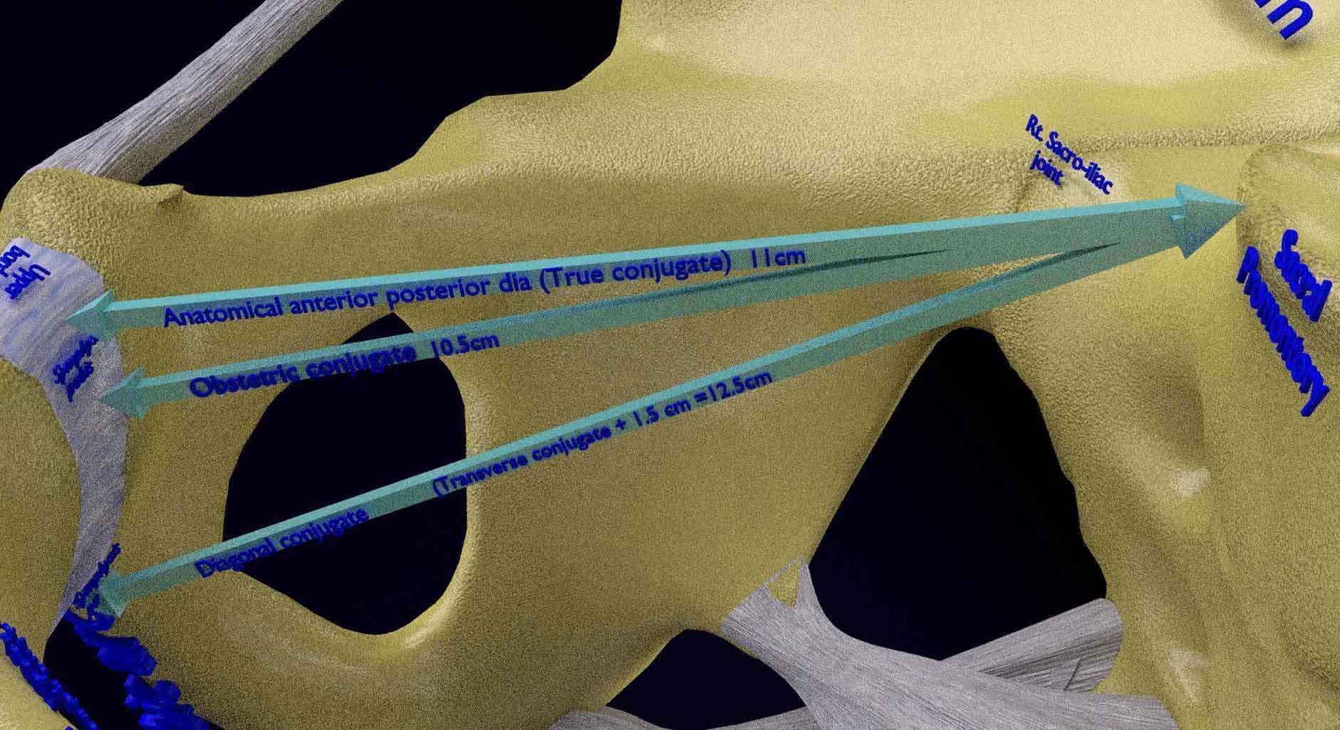 3D model Female pelvis clinical Pelvimetry dimension VR / AR / low-poly ...