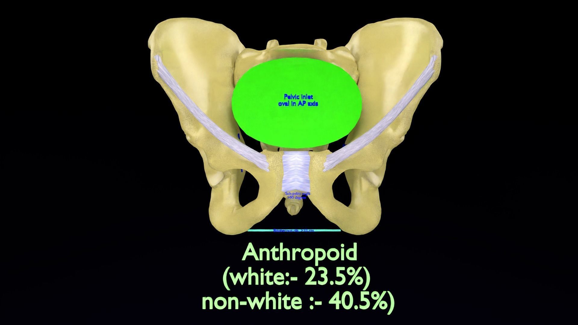 Pelvis types hip bone labelled detailed 3D model animated | CGTrader