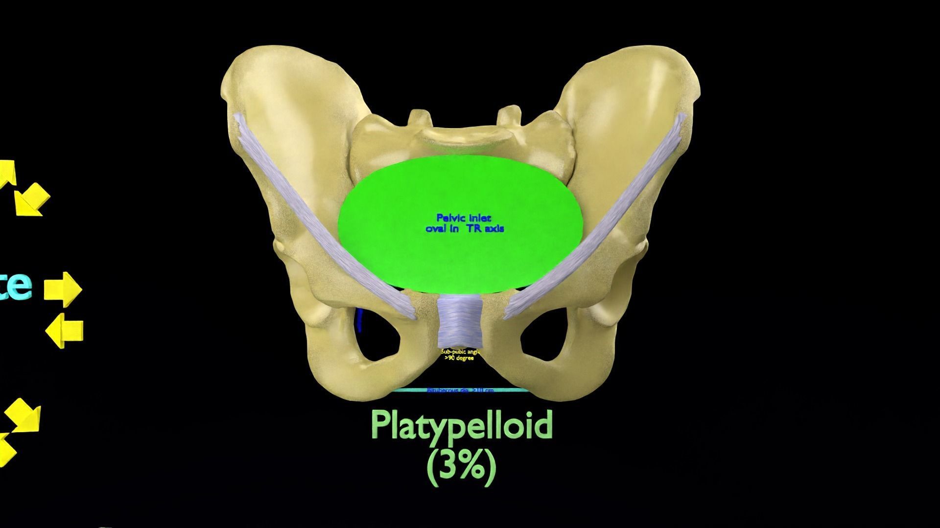 Pelvis types hip bone labelled detailed 3D model animated | CGTrader