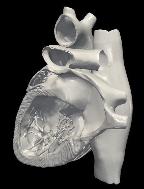 3d model of heart - apical 2 chamber plane 3D model 3D printable | CGTrader