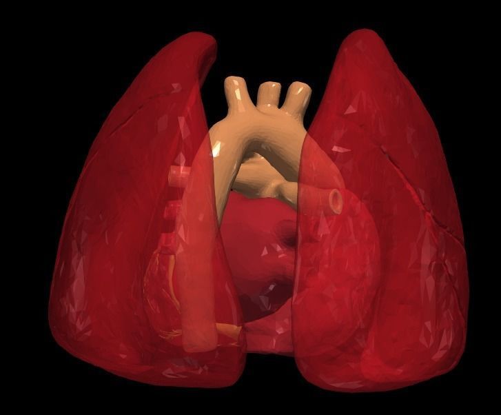 3D model of heart with transposition of the great arteries 3D model ...