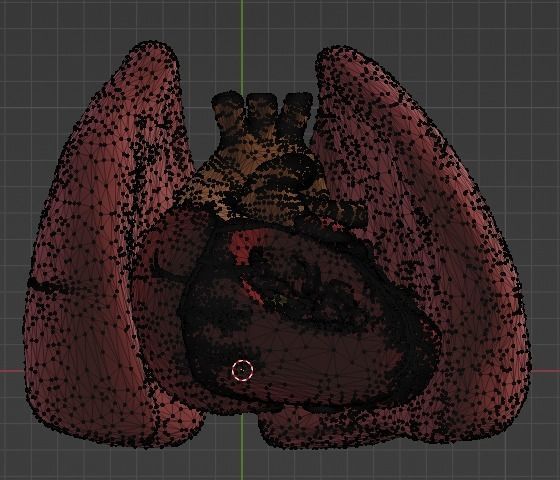 3D model of heart with transposition of the great arteries 3D model ...