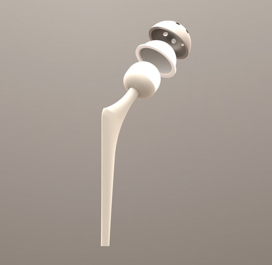 hip prosthesis 3D model 3D printable | CGTrader