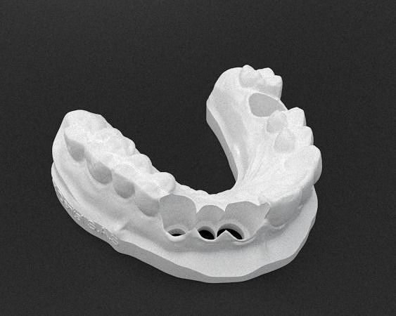 Model practices veneers 3D model 3D printable | CGTrader