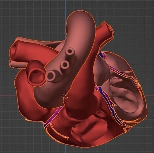 3d model of heart with atrial septal defect 3D model | CGTrader