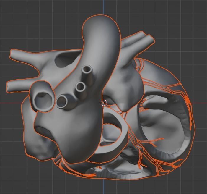 3d model of heart with bicuspid aortic valve 3D model 3D printable ...