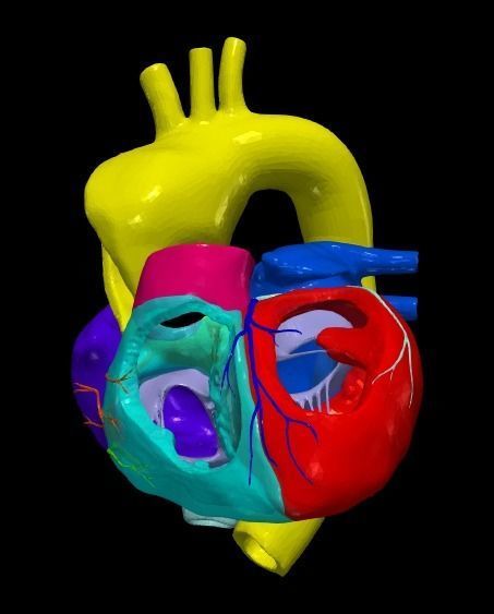 3d model of heart with bicuspid aortic valve 3D model 3D printable ...