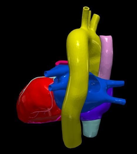 3d model of heart with bicuspid aortic valve 3D model 3D printable ...