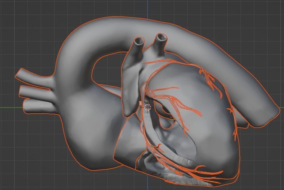 3d model of heart with bicuspid aortic valve 3D model 3D printable ...