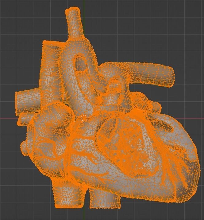 3d model of heart with common arterial trunk 3D model 3D printable ...