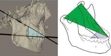 CG-BONWILL-TRIANGLE 25 - CURVE OF SPEE 3D model | CGTrader