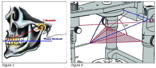 CG-BONWILL-TRIANGLE 25 - CURVE OF SPEE 3D model | CGTrader