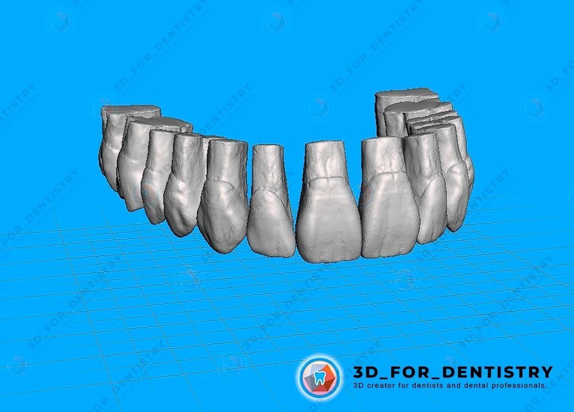 Dentes Maxila e Mandibula - Robtoly-Unique - Exocad 3D model | CGTrader