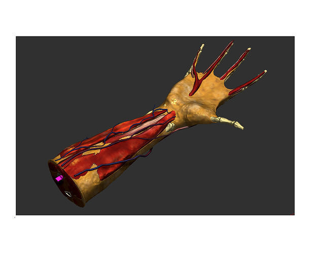 LigationPhant Artery plug 3D model | CGTrader