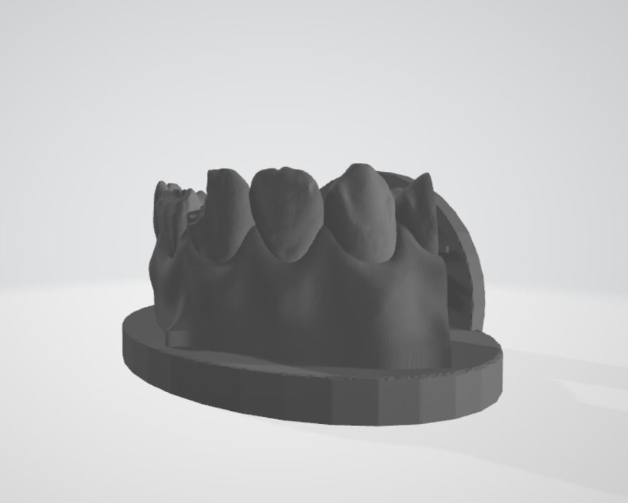 Segmented Anterior Class IV and Class VI by EDM DENTAL PRACTICE 3D ...