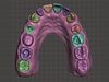 Segmented Full Mixed Arch Complex Cases by EDM DENTAL PRACTICE 3D model ...