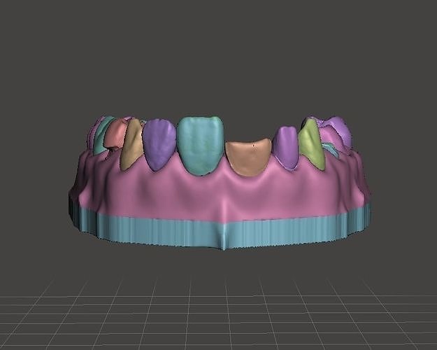 Segmented Full Mixed Arch Complex Cases by EDM DENTAL PRACTICE 3D model ...