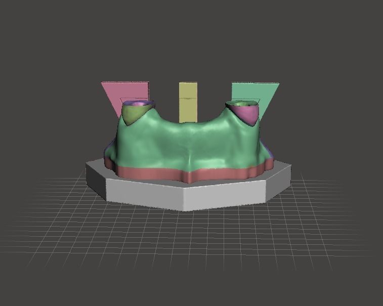 Segmented Canine Decaputation with Root Canal by EDM DENTAL 3D model 3D ...